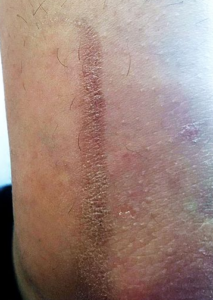 Acetic Acid Properties, Synthesis and Application - Safrole